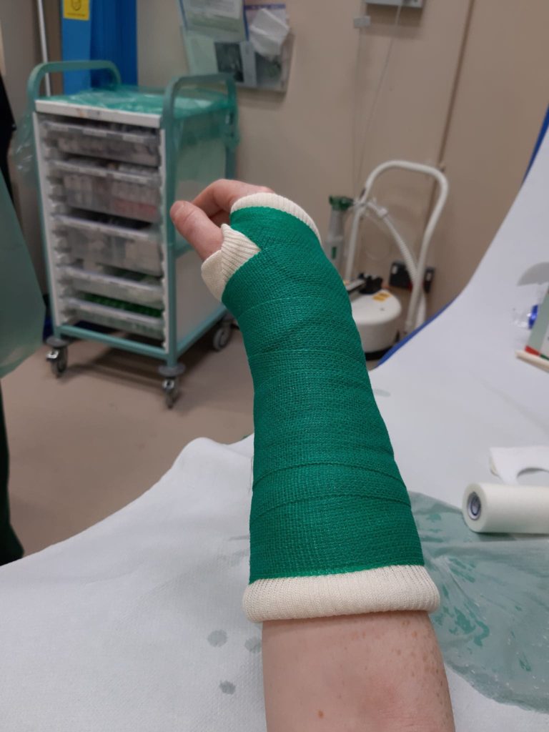 Soft Cast The Broken Bone Club Soft Cast The Broken Bone Club